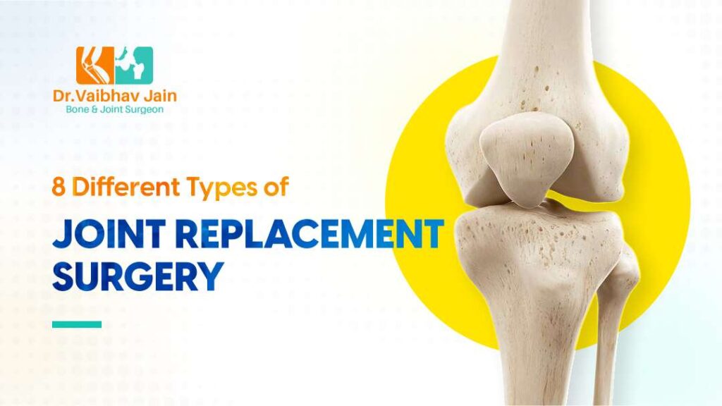 8 Different Types Of Joint Replacement Surgery | Dr. Vaibhav Jain