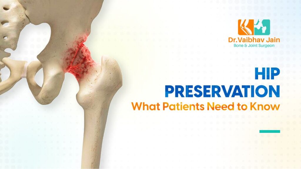 Hip Preservation Surgery: What Patients Need to Know